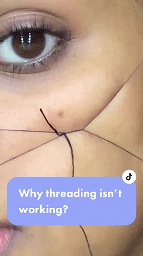 Common Issues with Threading: Solutions and Tips