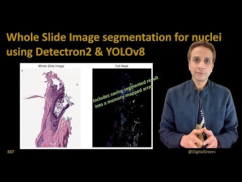 337 - Whole Slide Image segmentation for nuclei​ using Detectron2 and YOLOv8