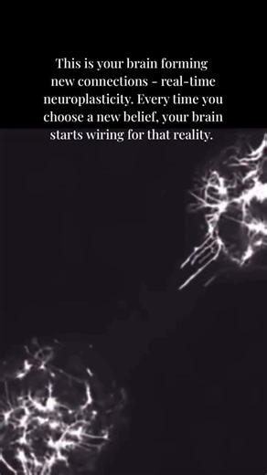 Women empowerment | Self-awareness | Mindset on Instagram: "THIS IS REAL-TIME REPROGRAMMING ☝️ Have you ever wondered what reprogramming actually looks like? Here it is - real footage of brain cells forming new connections. This is what’s happening when you reprogram your mind. You think a new thought. You think it again. And again. Until it becomes familiar - until it becomes a belief. As those new thoughts repeat, your neurons fire together, forming new pathways. Your brain starts wiring for a