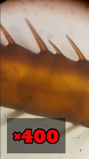 Cockroach under the microscope😯 #science #microbiology #microscope