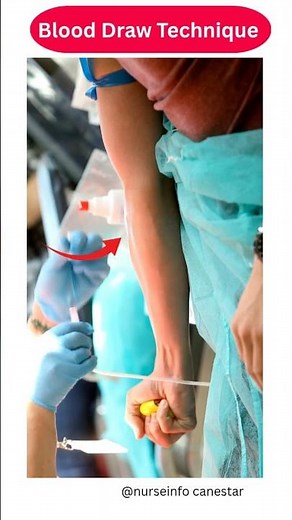 Blood Draw Technique