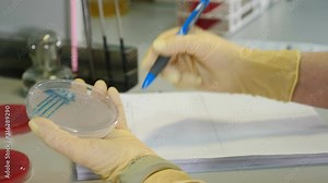 Colony of microbes and pathogenic fungi in petri dish. Microbiological laboratory work. Human analysis laboratory. Close-up shot of scientist working in reseach lab. 4 k video