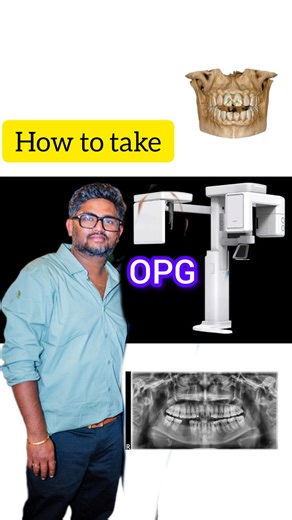 How to take OPG | CBCT : DEMONSTRATION #CBCT #OPG #dental #Dentistry #dentist #dentalphotography | DrAbhijit Biswas