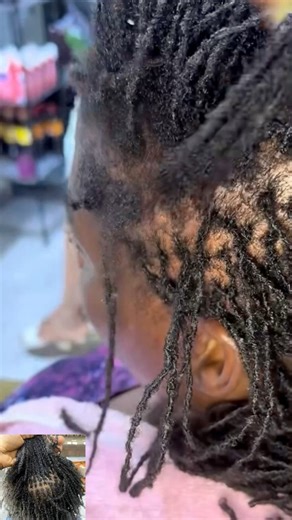 From thinning to thriving. How to repair your thinning locs #tinylocs #microlocs #locsrepair | Linda Olohi Jamilat Audu