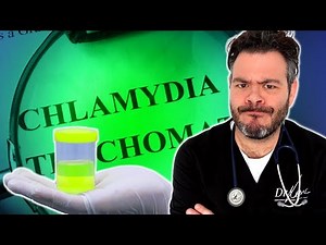 NO SYMPTOMS?? Could you have chlamydia!?