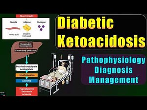 Diabetic Ketoacidosis (DKA): Pathophysiology, Diagnosis and Management