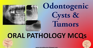 MCQs on Odontogenic Cysts and Tumors - Oral Pathology