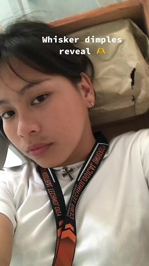 Whisker Dimples: The Unique Feature Explained