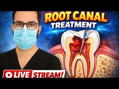 The Toothtalk is live Root canal treatment procedure