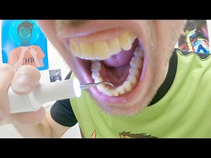 DIY Dental Drilling - cleaning plaque and tartar from my teeth as my own dentist (calculus removal)