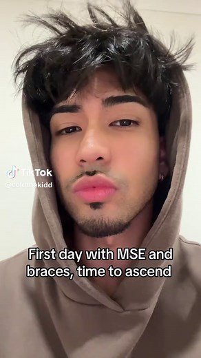 My First Day with MSE and Braces Explained