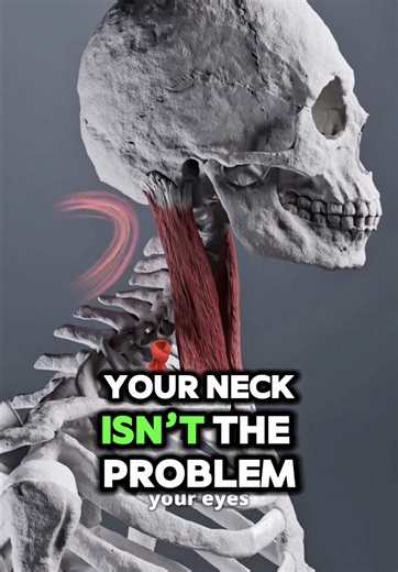 Correcting Forward Head Posture: Tips & Techniques