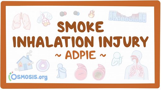 Smoke inhalation injury: Nursing process (ADPIE): Video, Causes, & Meaning | Osmosis