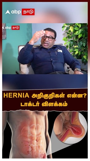 Dr Premkumar interview | Hernia அறிகுறிகள் என்ன ?டாக்டர் விளக்கம்