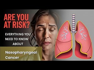 Nasopharyngeal Cancer Explained Causes, Symptoms and Treatment, All Insights