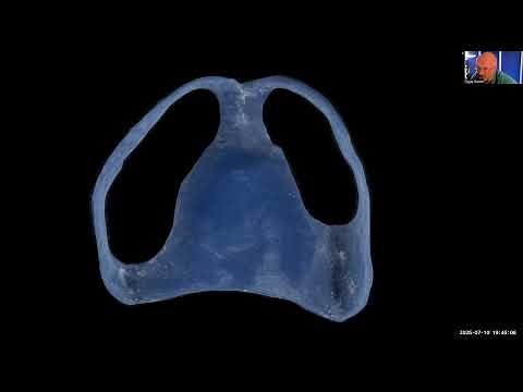 Dr Finlay Sutton – Immediate Complete Upper Denture: From Extractions to Final Fit Study Club