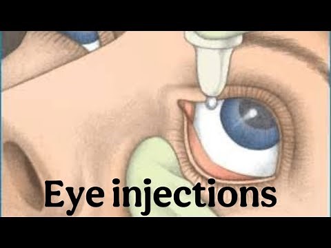 Eye Injections - All you need to know