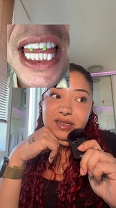 13K views · 101 reactions | Als je je snake eyes piercing goed verzorgt en de juiste nazorg toepast, komt het helemaal goed  Problemen ontstaan pas als mensen laks zijn, niet luisteren of het beter denken te weten. Volg gewoon mijn advies, behandel je piercing met respect. Dan blijft 'ie mooi, gezond en je hebt er jarenlang plezier van. Trust the process & trust your piercer. | MIRRDO. PIERCINGS | Facebook