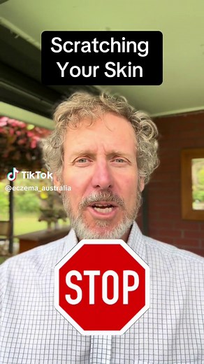 Eczema Relief: Stop Scratching Your Skin with These Tips