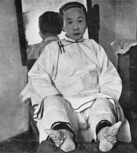 Jai Silva on Instagram: "Chinese lady whose feet were bound from childhood, photographed in the 1890s. Footbinding was the Chinese custom of breaking and tightly binding the feet of young girls in order to change their shape and size. Feet altered by foot binding were known as lotus feet, and the shoes made for these feet were known as lotus shoes. In late imperial China, bound feet were considered a status symbol and a mark of feminine beauty. However, footbinding was a painful practice that li