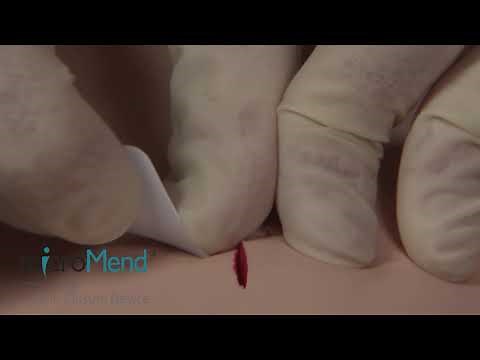 how to apply micromend video 591