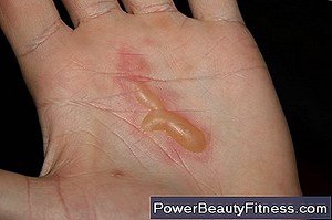 Les Symptômes Du Sinus Candidose 💪💪 Tout À Propos Des Modes De Vie Sains Et De Remise En Forme - 2025