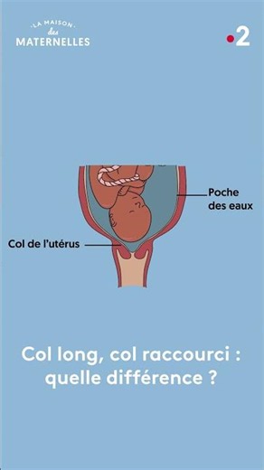 Le col de l'utérus pendant l'accouchement - #LMDM