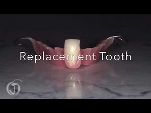 Temporary Tooth-A Flipper Tale