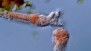 Family Freshwater Rotifer Under Dic Microscope Stock Footage Video (100% Royalty-free) 3789032649 | Shutterstock