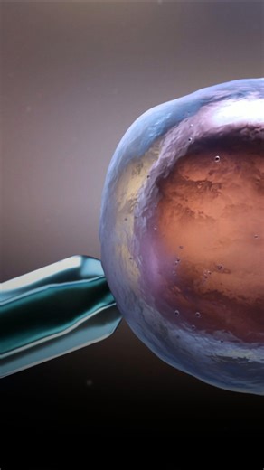 Comment fonctionne la fécondation in vitro : le traitement par étapes