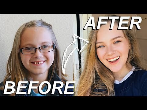 GETTING MY BRACES OFF AFTER 8 YEARS OF WAITING!