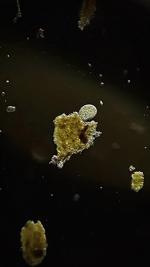Infusoria Feeding Behavior: Moss Under Microscope