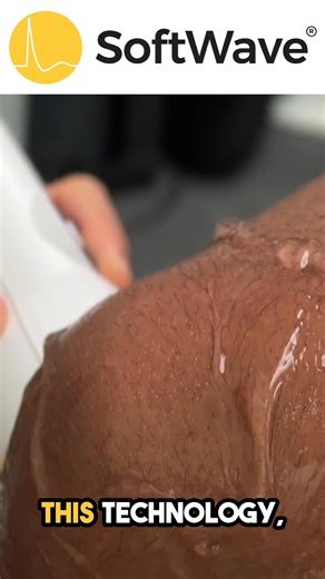 The technology top clinics are calling their biggest practice upgrade in years. Dr. Adelena Izold, ND, thought she’d seen it all - until she tried SoftWave Therapy. After one treatment, she was able to bend her knee again for the first time in years. That single session changed how she practiced medicine. Now, providers everywhere use SoftWave to: ▪ Treat a broad range of musculoskeletal conditions ▪ Deliver real relief in just minutes ▪ Improve outcomes and patient retention ▪ Build a predictab