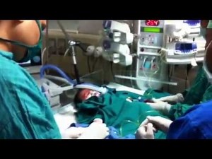 Partial Exchange Transfusion in Neonate