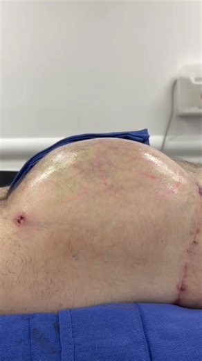 BEFORE TRANSFORMATION + AFTER | We will be going more in depth regarding the procedures ✨ #cosmetics