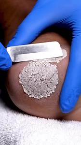 Foot ASMR Spa | Soothing Heel Scrape CYKL ##footcare #heeleexfoliation #pedicure #oddlysatisfying #dryskinremoval Enjoy clean, relaxing foot-care ASMR with gentle heel exfoliation and natural callus removal. Disclaimer: AI-generated educational & relaxation content. | Viral video 427