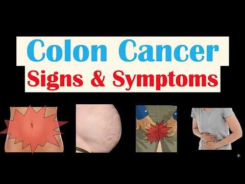 Colon Cancer (CRC) Signs & Symptoms (& Why They Occur)