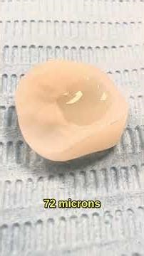 Fit better? 3D print crown precision explained! 💡