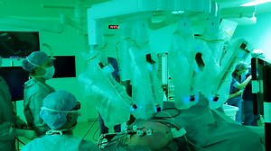 Robotic Pancreatoduodenectomy for Pancreatic Head Cancer: a Case Report of a Standardized Technique