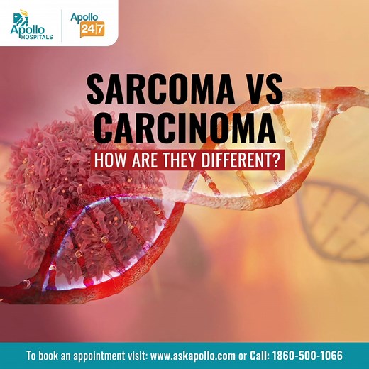 71 reactions | Sarcoma and Carcinoma are both cancer types but are two different forms of cancer. The main difference between carcinoma and sarcoma is their location. To read on Squamous cell carcinoma, Click the link below: https://healthlibrary.askapollo.com/what-is-squamous-cell-carcinoma-of-the-skin/ To seek a medical opinion, Call Apollo Helpline 1860 500 1066 for assistance. #apollohospitals #askapollo #cancer #carcinoma #sarcoma | Apollo Hospitals | Facebook