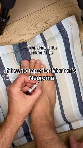 How to tape for Morton’s Neuroma. 🦶 Follow to support your foot. ______ #foot #pain #rehab #physio #physiotherapy #physiotherapist #injury #recovery #workout #fitness | Tape Lab