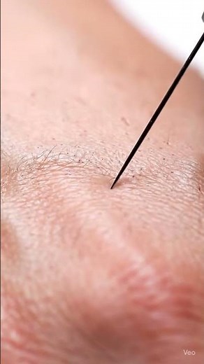 Medical Needle Piercing Skin in Extreme Macro