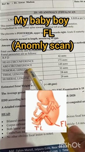 FL in Anomaly Scan Baby Boy | Femur Length in 20 Weeks Ultrasound Explained
