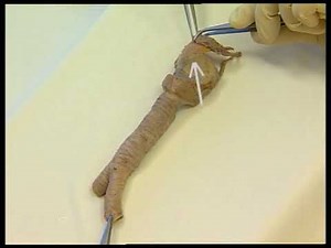 Dissection du corps humain, commentée : Larynx