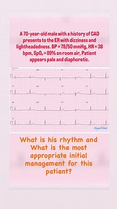 🫀 ECG Challenge! 🫀 Look closely at the rhythm strip 📉 ❓ What is the rhythm? ❓ What is the MOST appropriate initial management for this patient? Think fast like you’re in the ER 🚑⏱️ Drop your answers in the comments 👇 Let’s test your emergency nursing & critical care skills 💪👩‍⚕️👨‍⚕️ ⚡ Clue: Early recognition = lifesaving intervention #EmergencyNursing #ECGInterpretation #CriticalCare #NurseLife #ACLS | Moayad Wishah