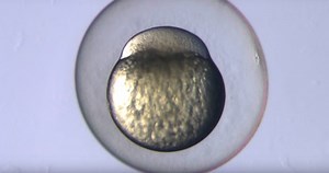 Fish Models Provide New Insight Into Rare Genetic Diseases | Genetics And Genomics