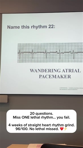 These past four weeks were straight grind mode. After my shifts, I was studying heart rhythms, lethal arrhythmias, blocks, STEMIs, VTach, VFib — over and over until I could recognize them instantly. This wasn’t just about passing a 20-question exam. If you miss one lethal rhythm, you fail. Period. No excuses. #ekg #nursing #heart #hospital #scrublife