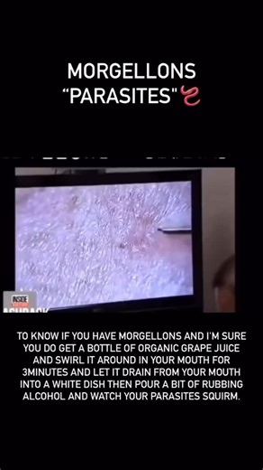 360 reactions · 12 shares | THIS is Morgellons nanotechnology...