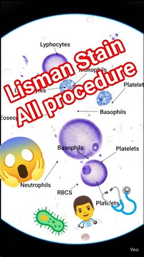 lisman Stain || Hematology || #lab #aiims #blooddonate #blooddonate #hematology #histopathology