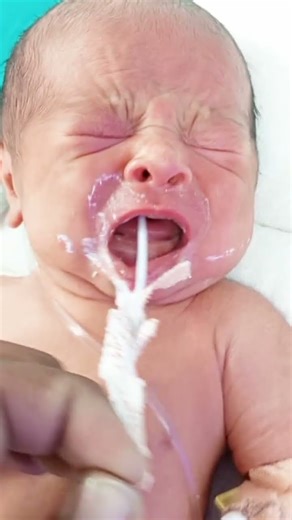 NICU Protocol: Handling Preterm Babies 👶🩺 #baby #neonatalcare #cutebaby #nicu #physiotherapy